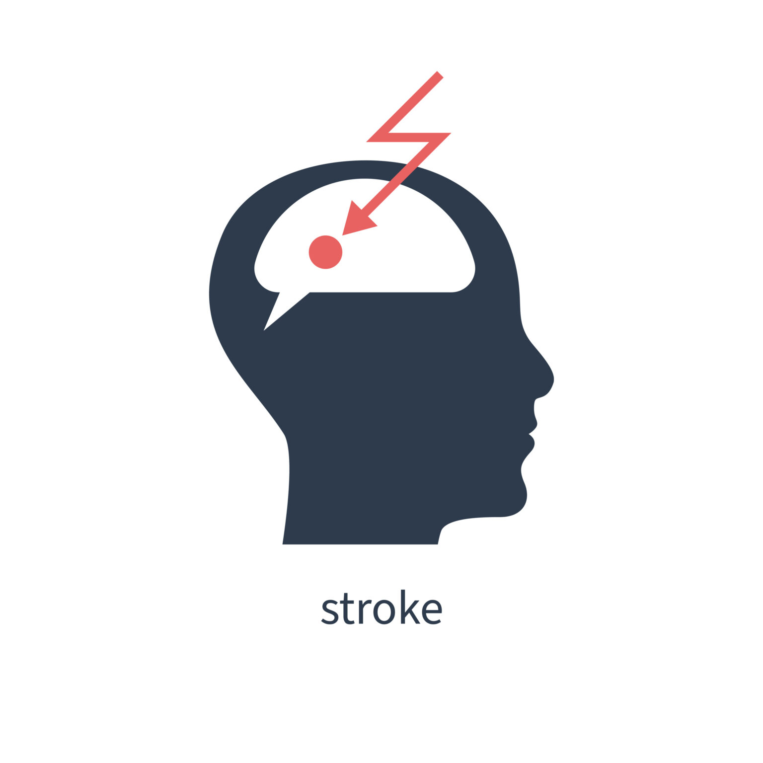 Posterior Circulation Stroke | The DADA2 Foundation